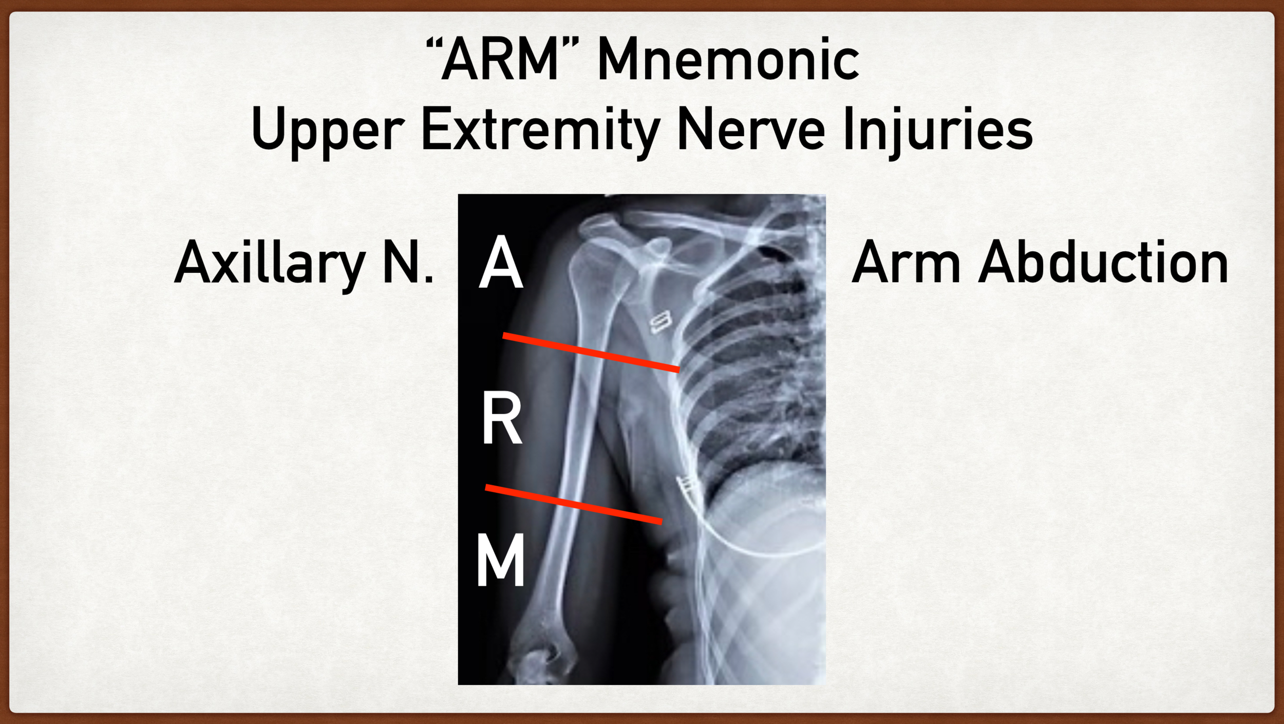Axillary Nerve Damage
