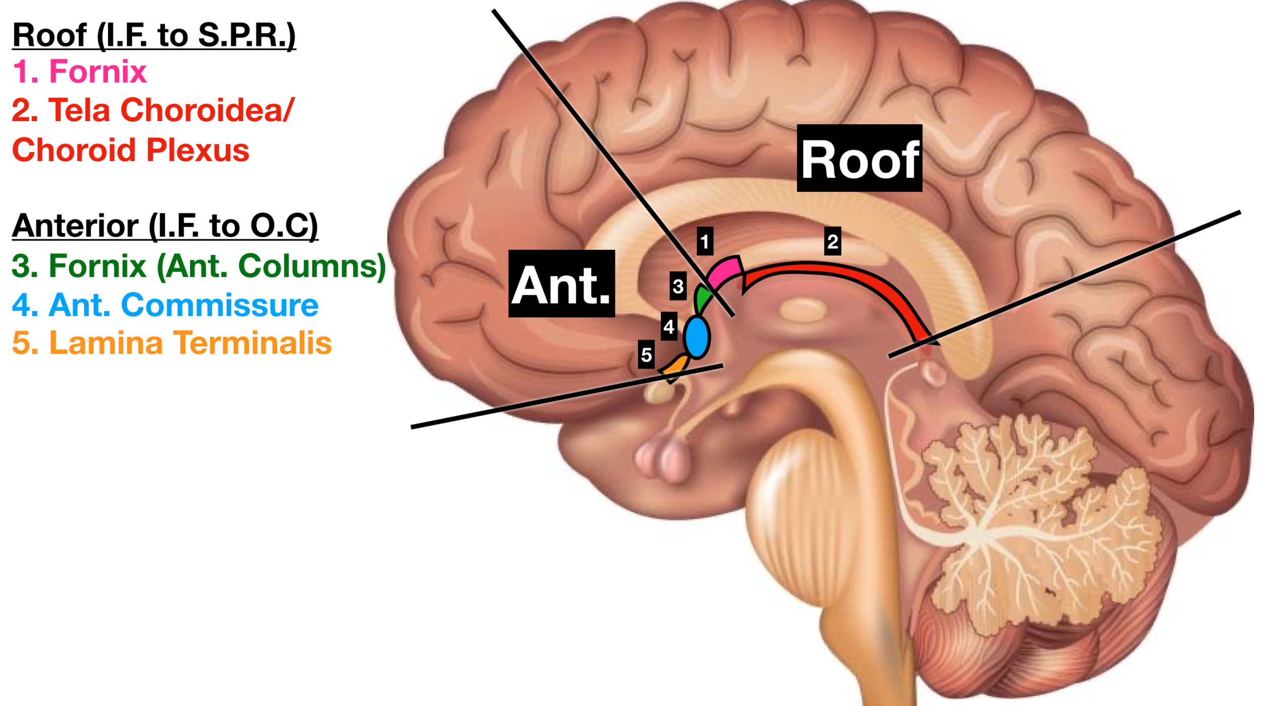 Interventricular Foramen
