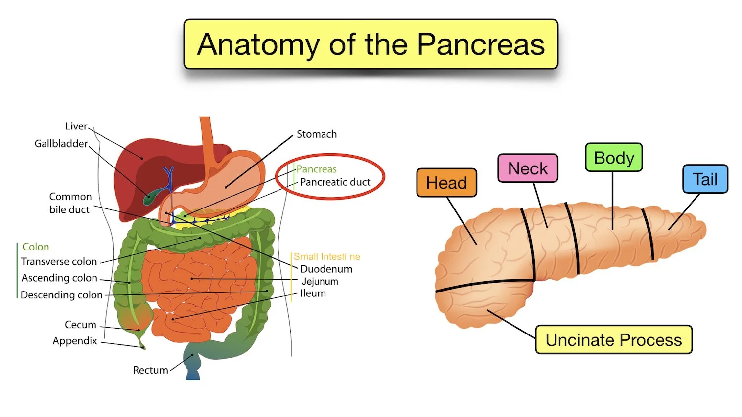 Pancreas Type 2 Diabetes Diagram Arocreative