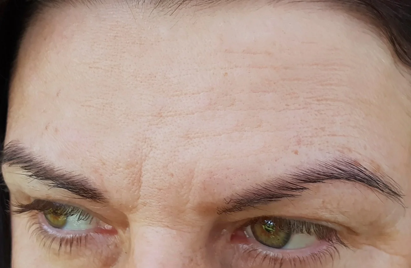 5 Common Skin Concerns | Sokörpe Laboratories — Sokörpe