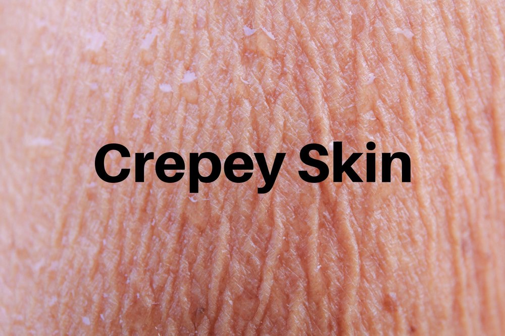 Crepey Skin: Common Causes and How to Tackle It | Sokörpe Laboratories — Sokörpe