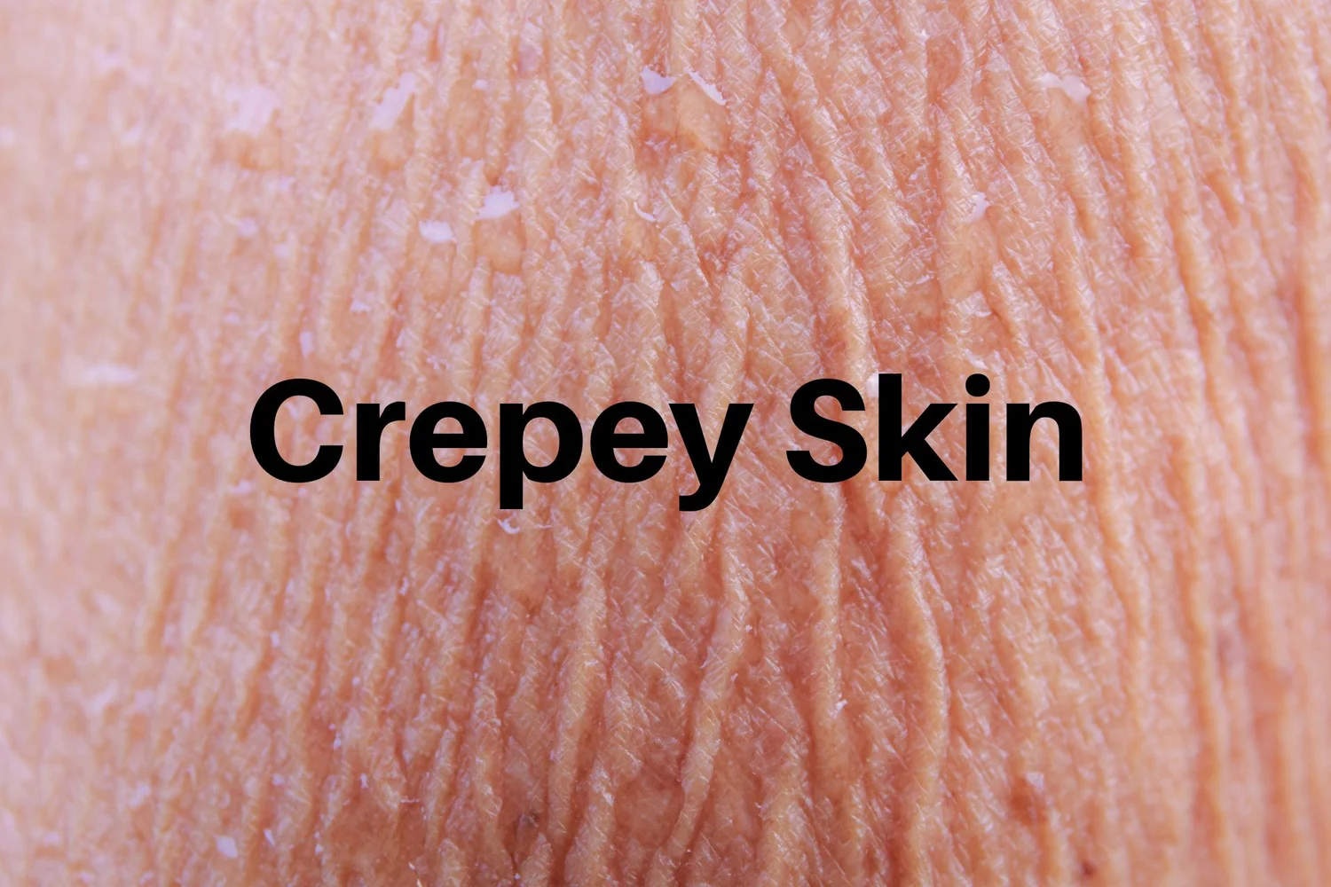 Crepey Skin: Common Causes and How to Tackle It | Sokörpe Laboratories ...