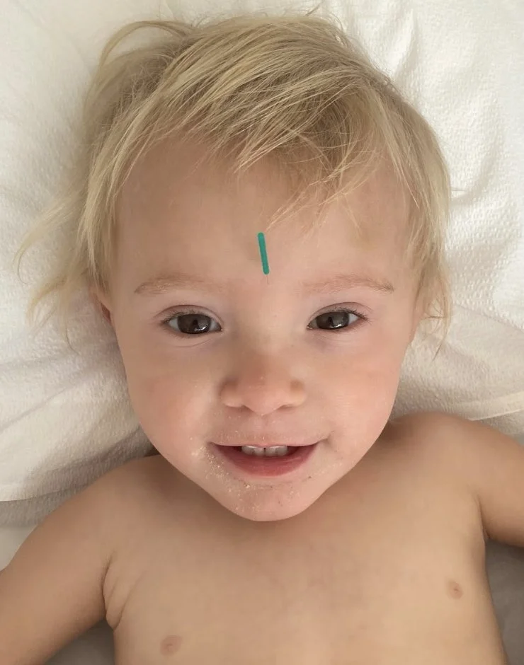 Pediatric Acupuncture & Shonishin — Light & Dark Acupuncture ...