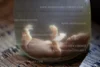 Water Immersion Photography After Infant Loss: How This Gentle Practice ...