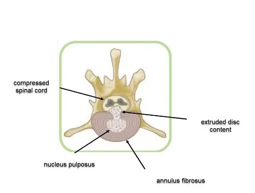 The Expert's Guide to IVDD in Dogs — Sage Veterinary Imaging | Human ...