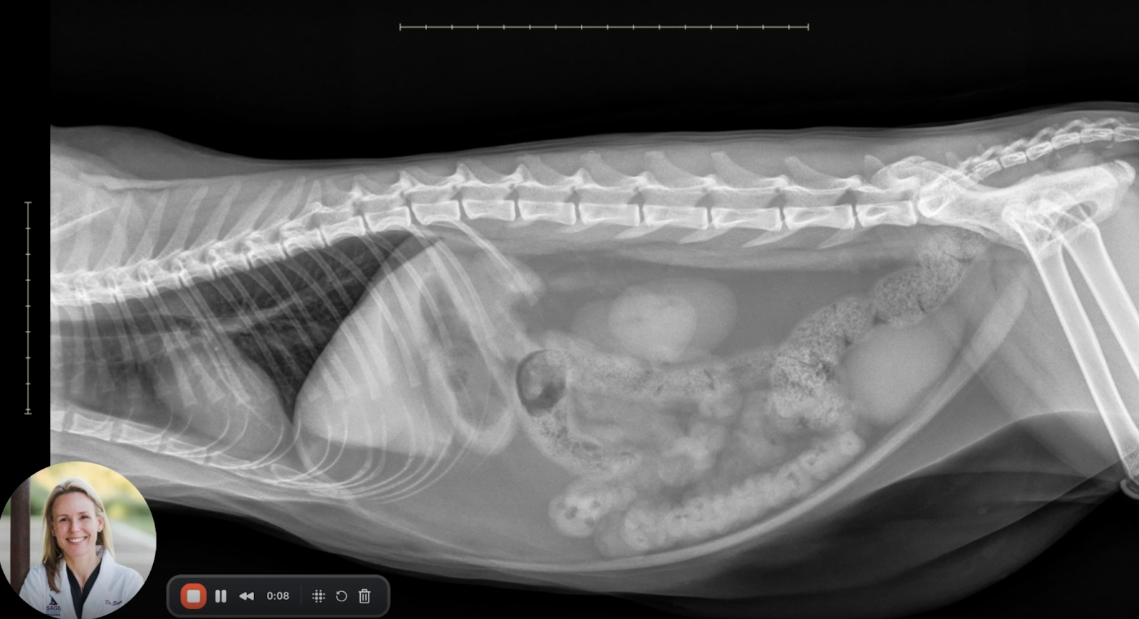 Case Review: Radiographic Signs of Linear Foreign Body Obstruction in a ...