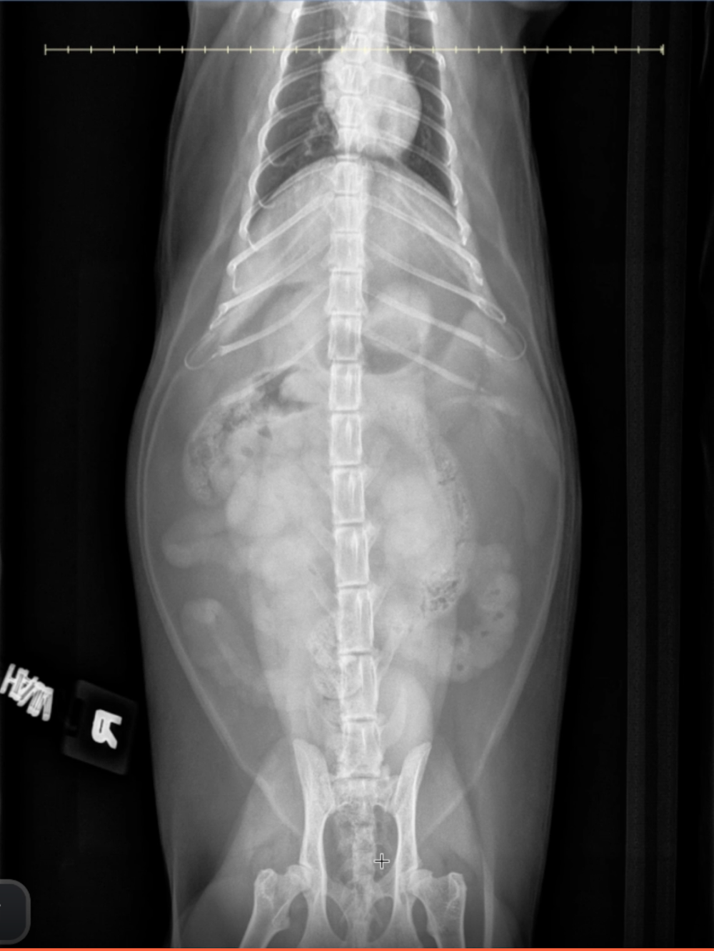 Case Review: Radiographic Signs of Linear Foreign Body Obstruction in a ...