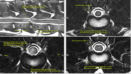 The Expert's Guide to IVDD in Dogs — Sage Veterinary Imaging | Human ...