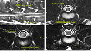 The Expert's Guide to IVDD in Dogs — Sage Veterinary Imaging