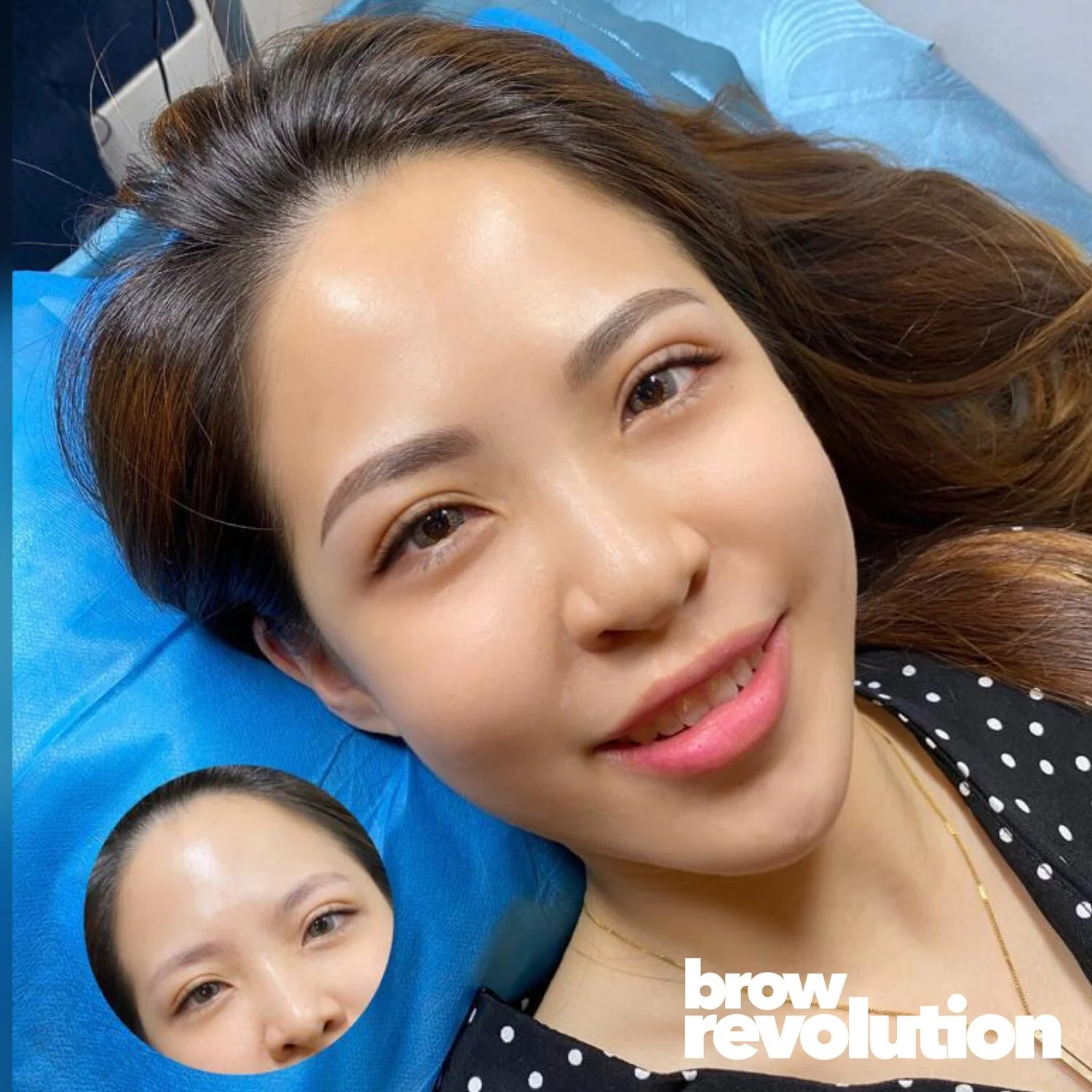 Brow Repair — Brow Revolution