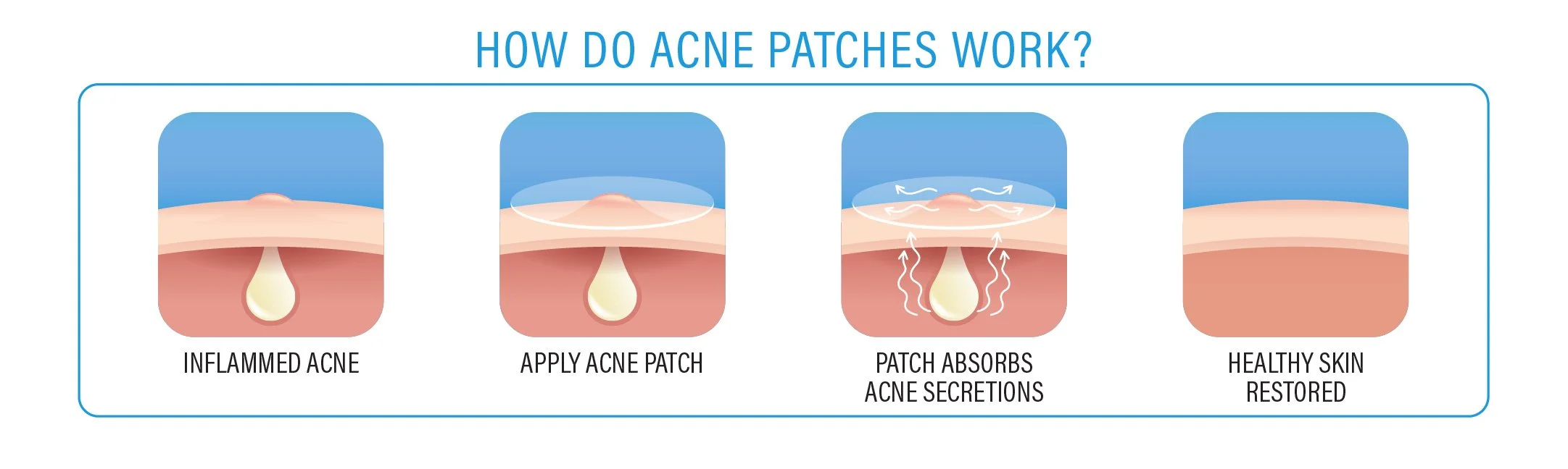 ACNE PATCHES — WORMSER GROUP