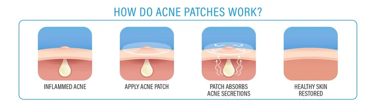 ACNE PATCHES — WORMSER GROUP