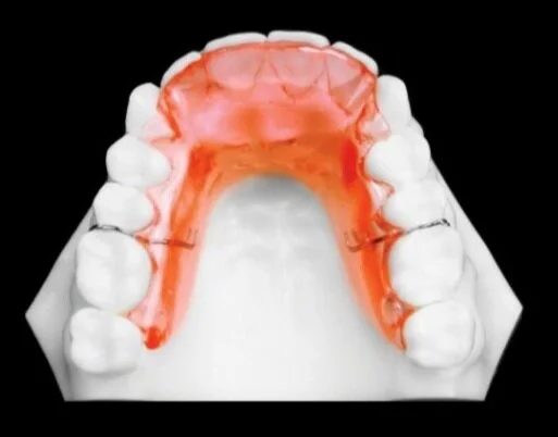 Appliances Overview — Tri-Valley Orthodontics Dr. Jesse Ko & Dr. Anne ...