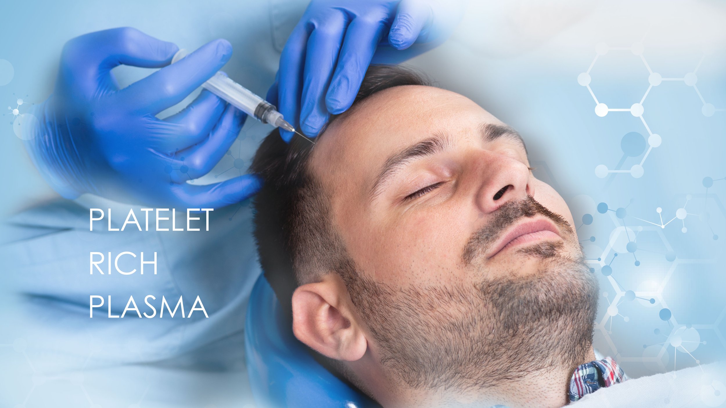 About PRP — Lansing Hair Restoration
