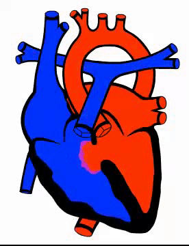 Let's Talk: VSD — THE NURSE NATALIE