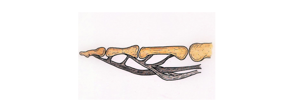 WHAT TO DO WHEN YOU CUT YOUR FINGER AND IT WON’T BEND — Dominion ...