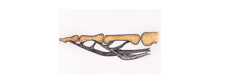 WHAT TO DO WHEN YOU CUT YOUR FINGER AND IT WON’T BEND — Dominion ...