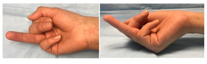 WHAT TO DO WHEN YOU CUT YOUR FINGER AND IT WON’T BEND — Dominion ...