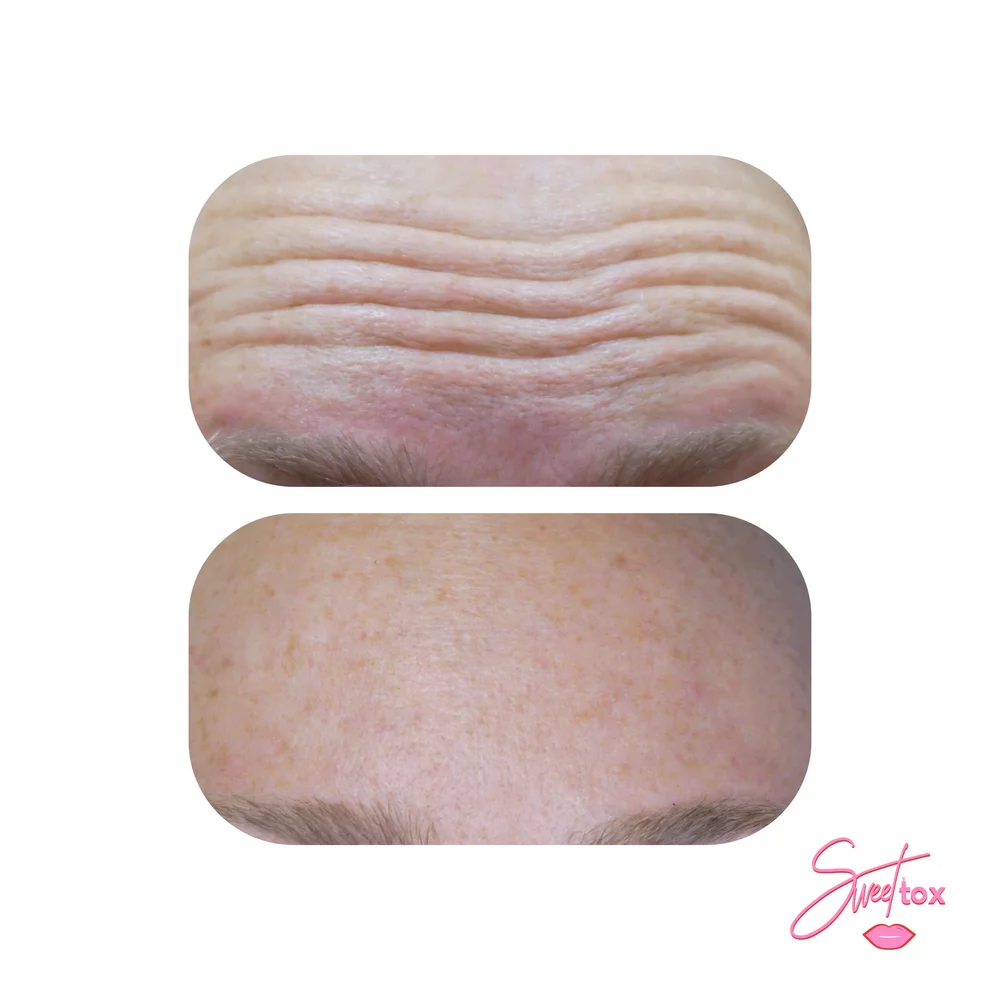 Gallery 1 — Sweet Tox