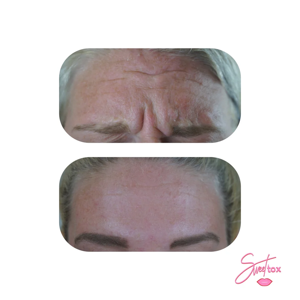 Gallery 1 — Sweet Tox