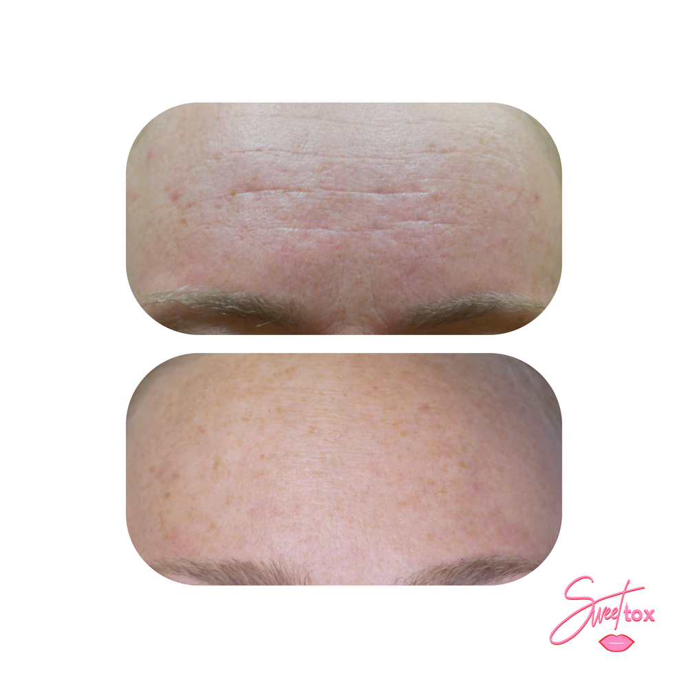 Gallery 1 — Sweet Tox