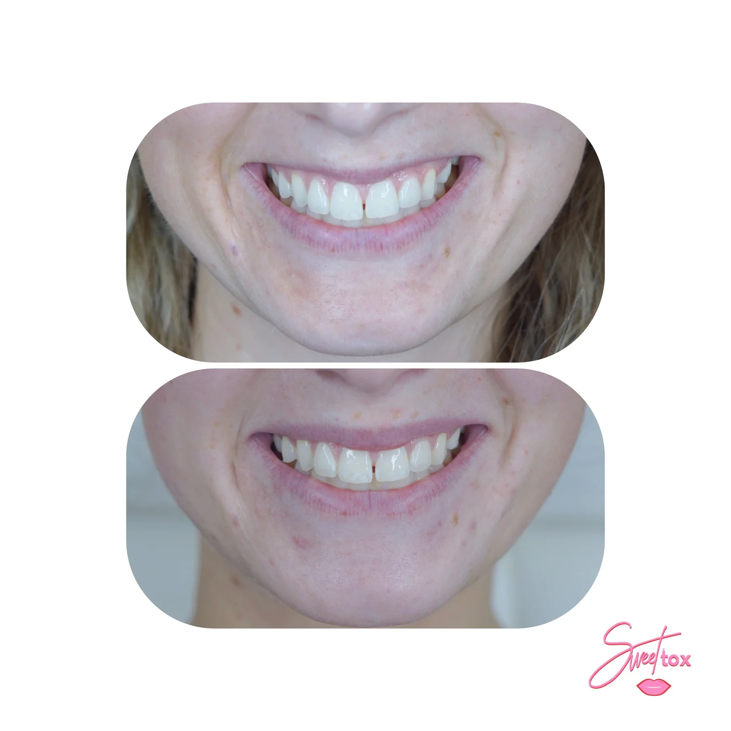 Gallery 1 — Sweet Tox