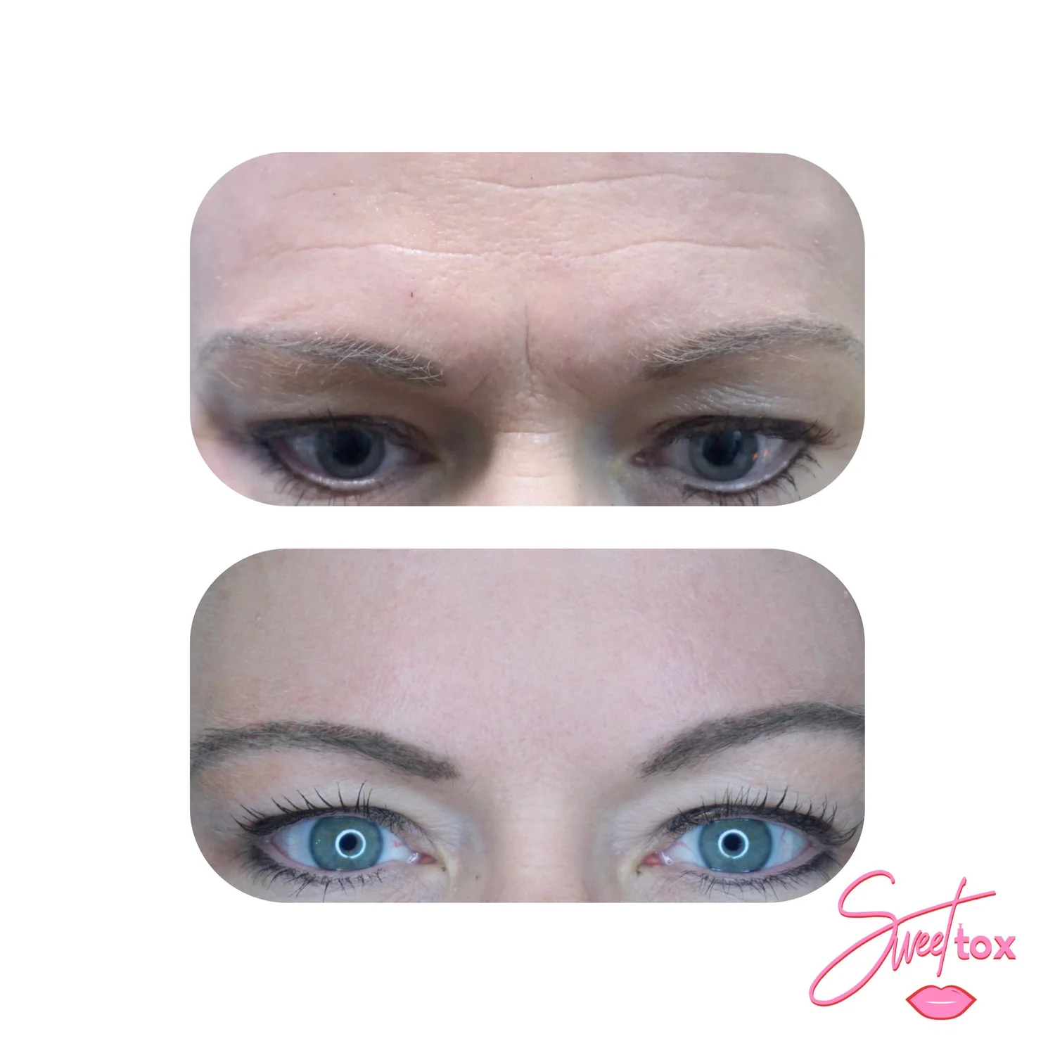 Gallery 1 — Sweet Tox