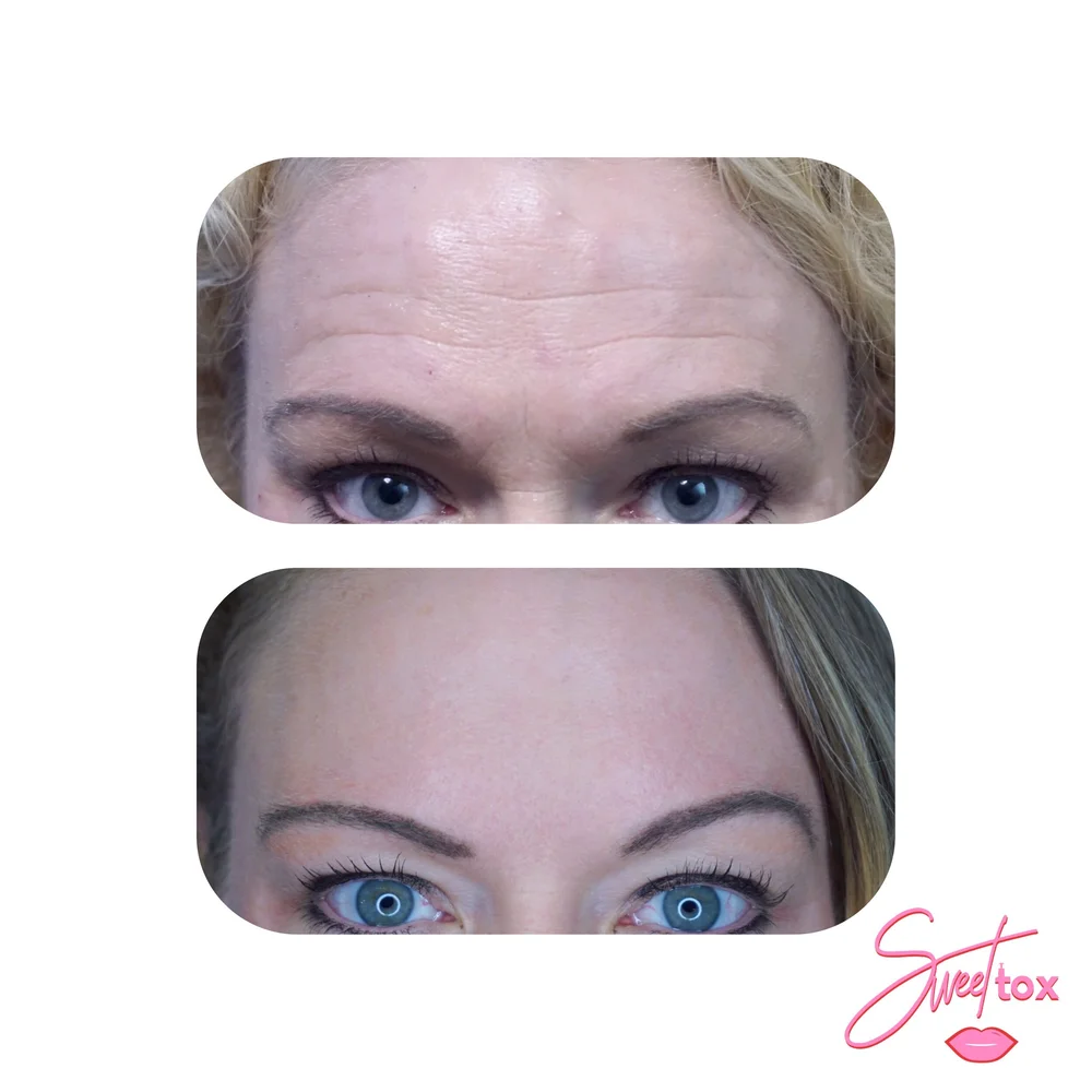 Gallery 1 — Sweet Tox