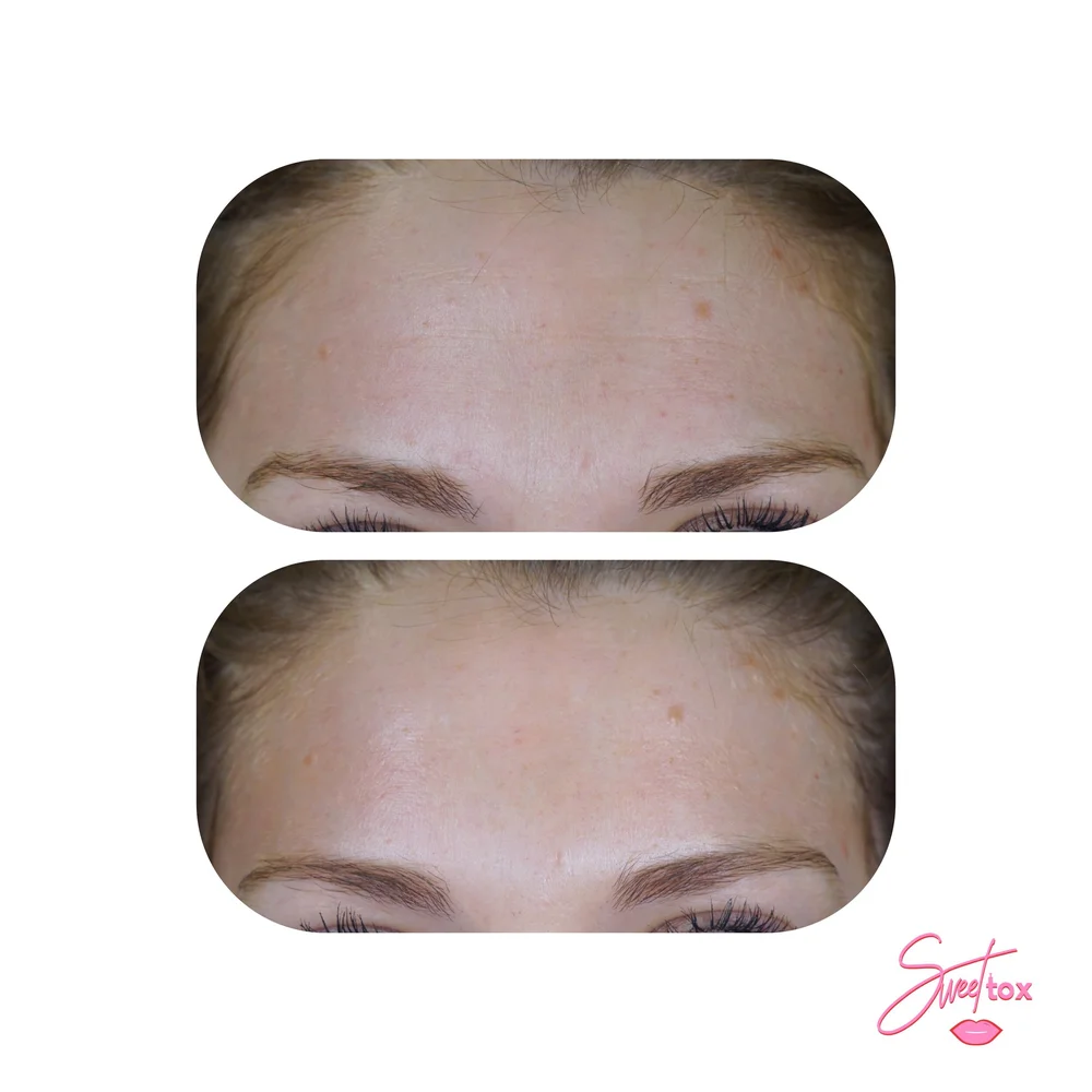 Gallery 1 — Sweet Tox