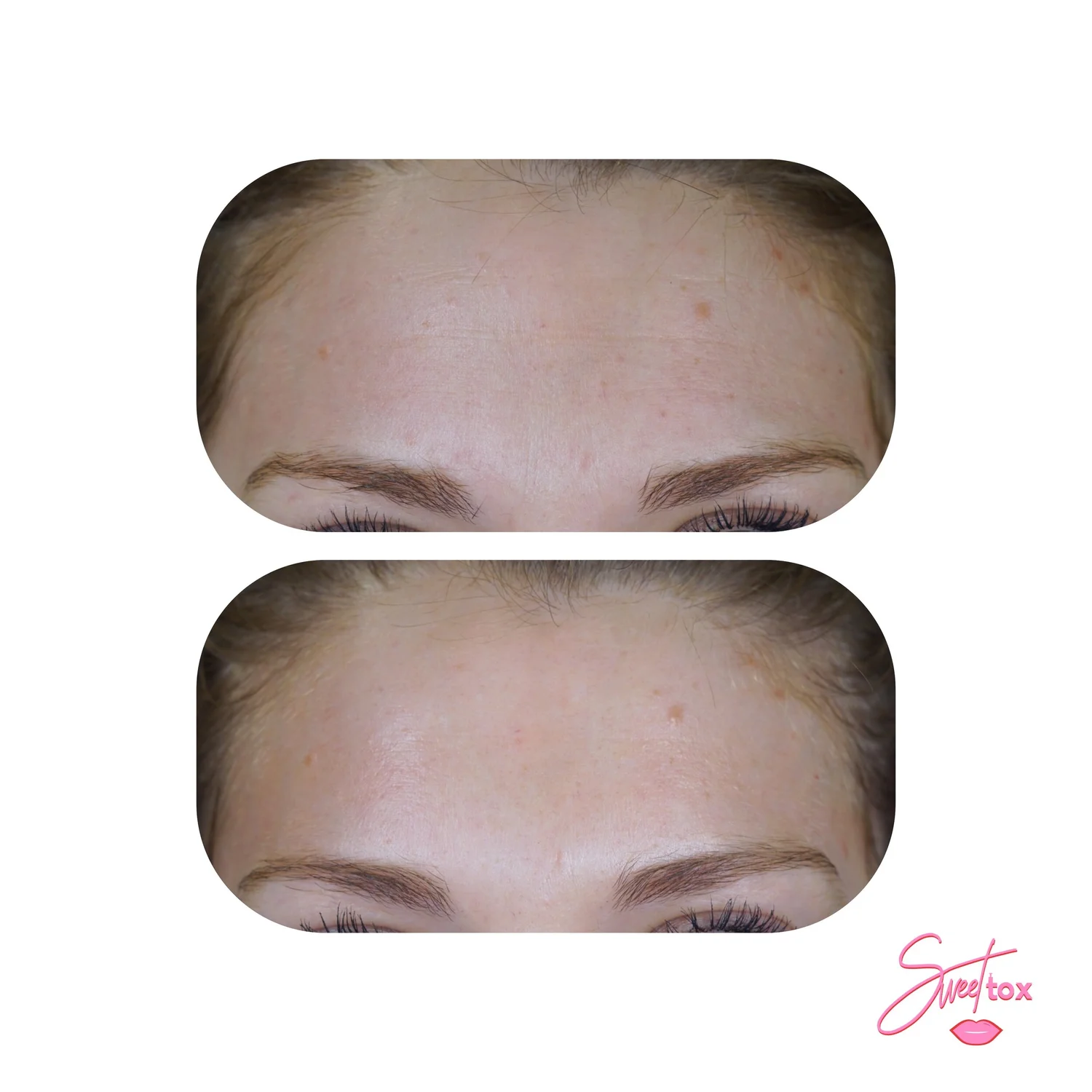 Gallery 1 — Sweet Tox