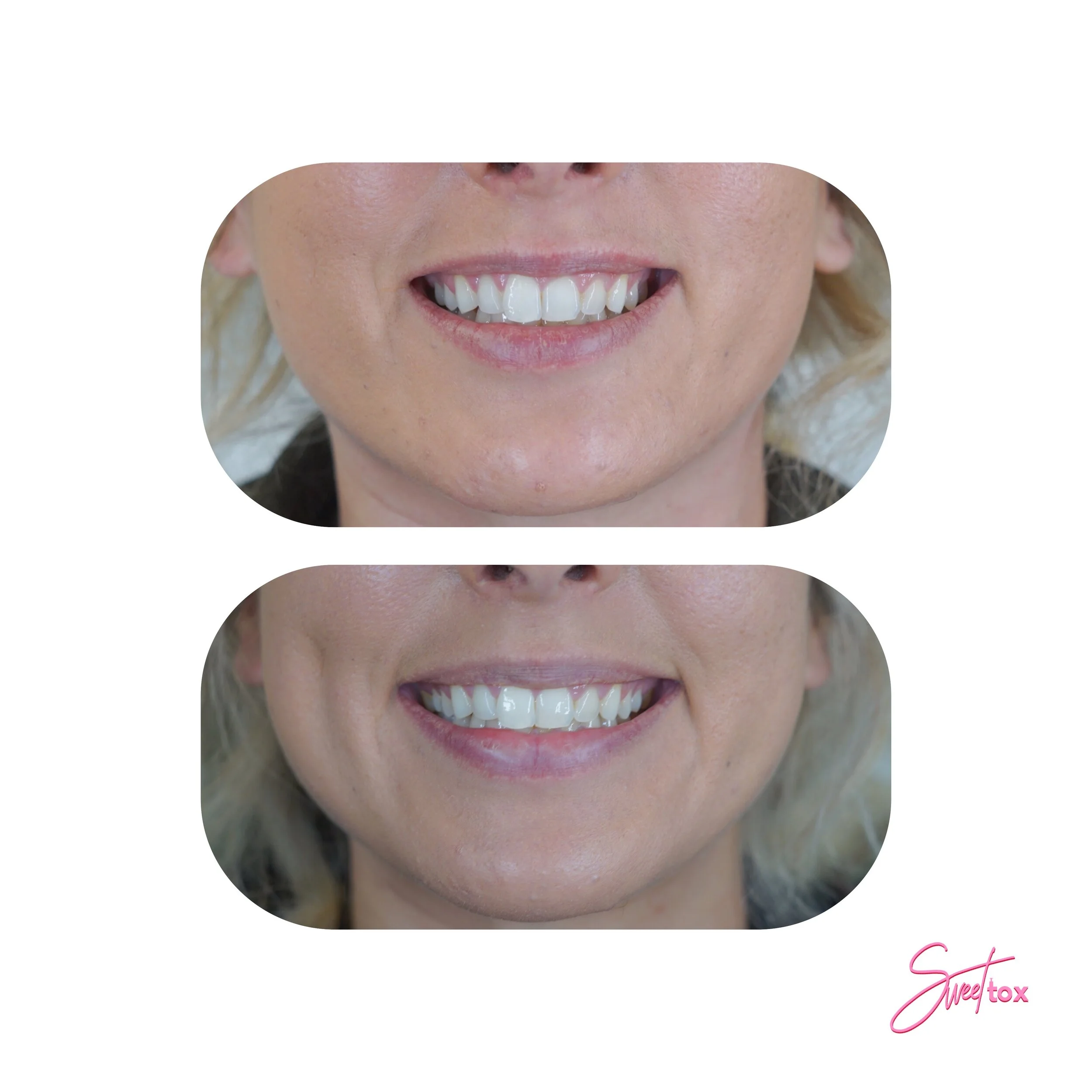 Gallery 1 — Sweet Tox