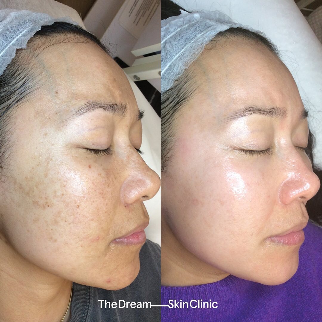 The Dream Skin Clinic