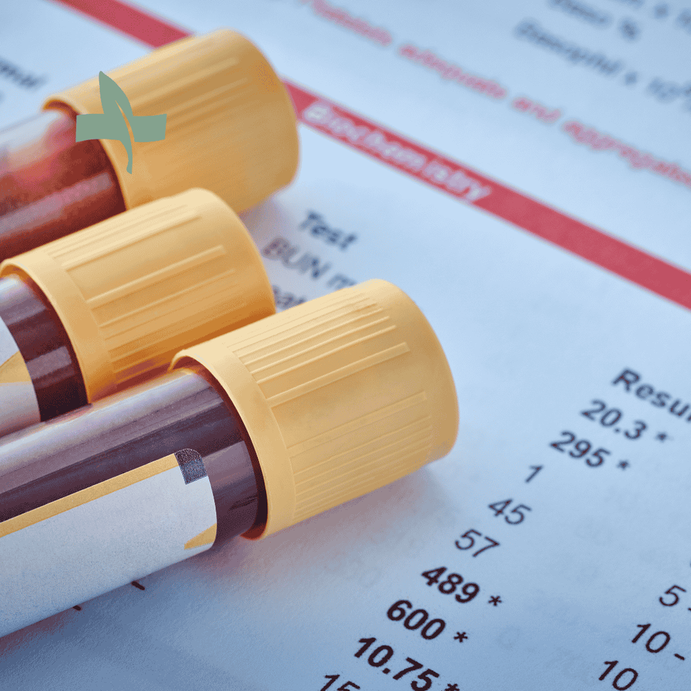Top 5 Blood Tests You Should Get Every Year — SageMED