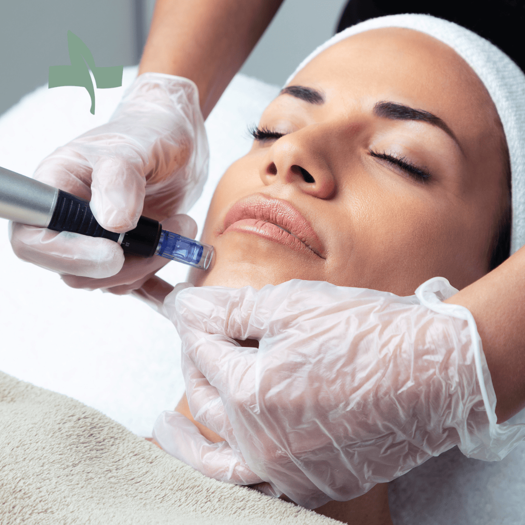 Collagen PIN Microneedling | Skin Treatment — SageMED