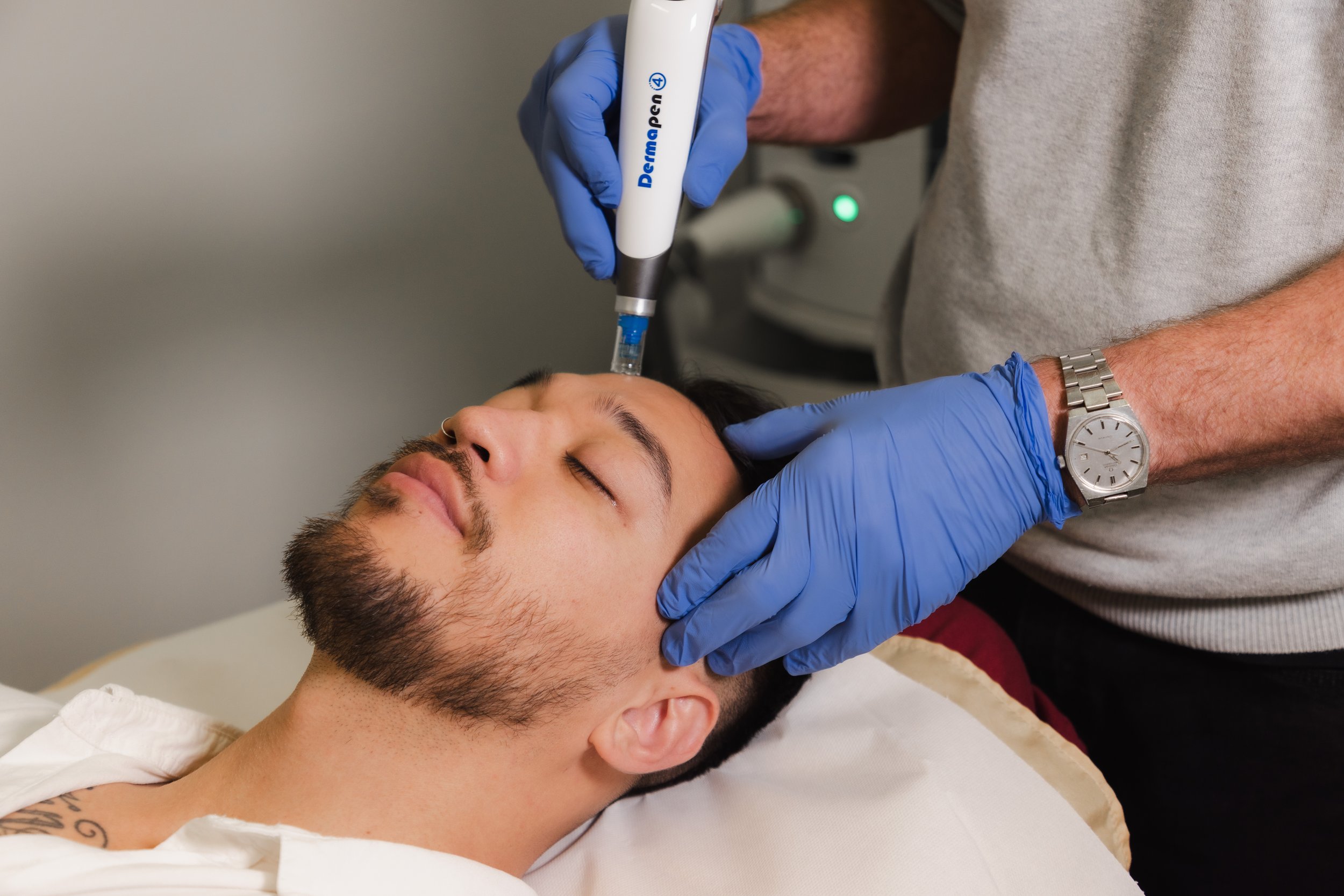 Micro Needling — CIMED Aesthetics