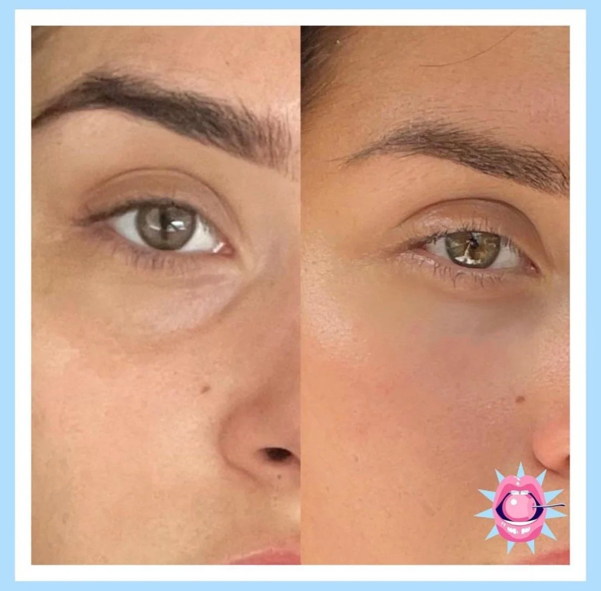 Brighton based cosmetic practitioner | CherryBomb Aesthetics | Your ...