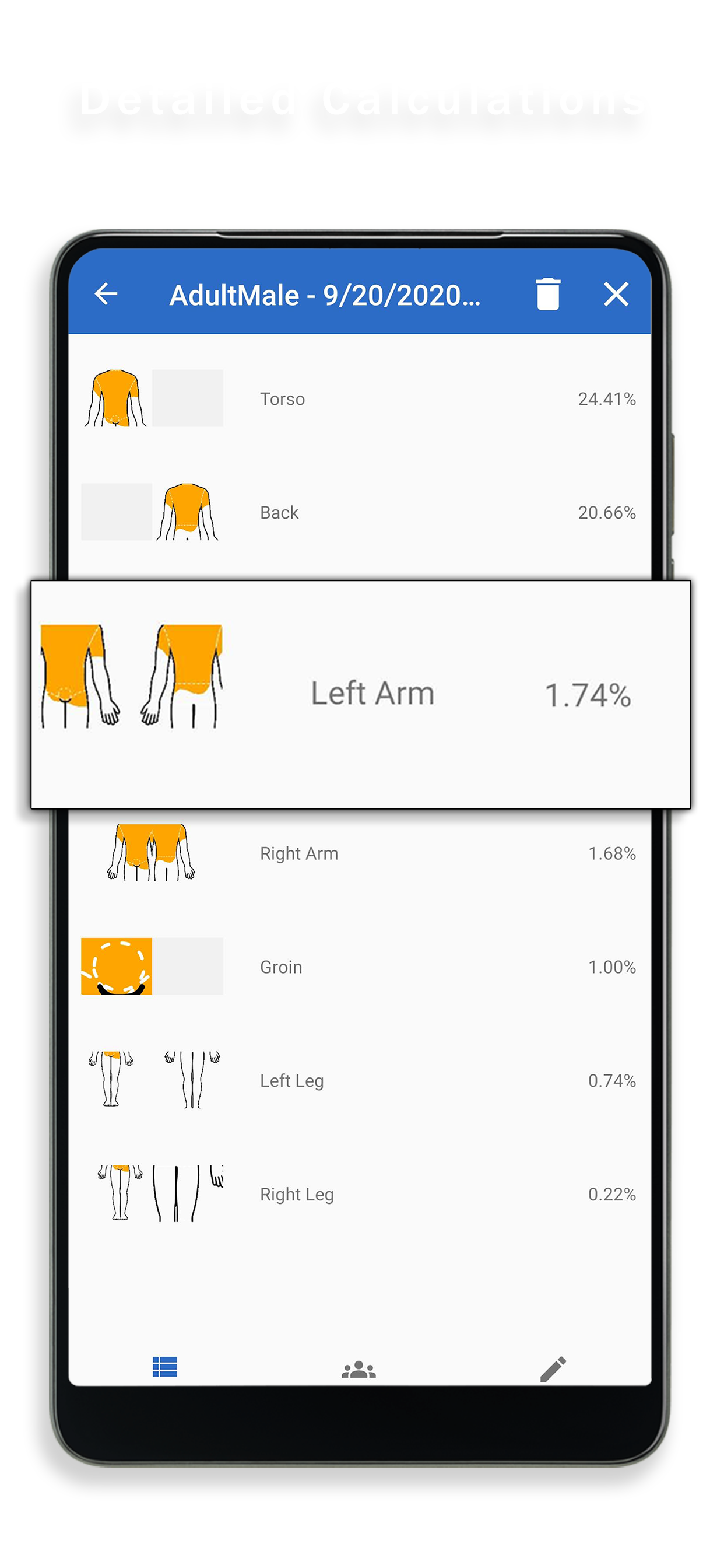 Surface Burn Calculator — CodeSoupCafe LLC