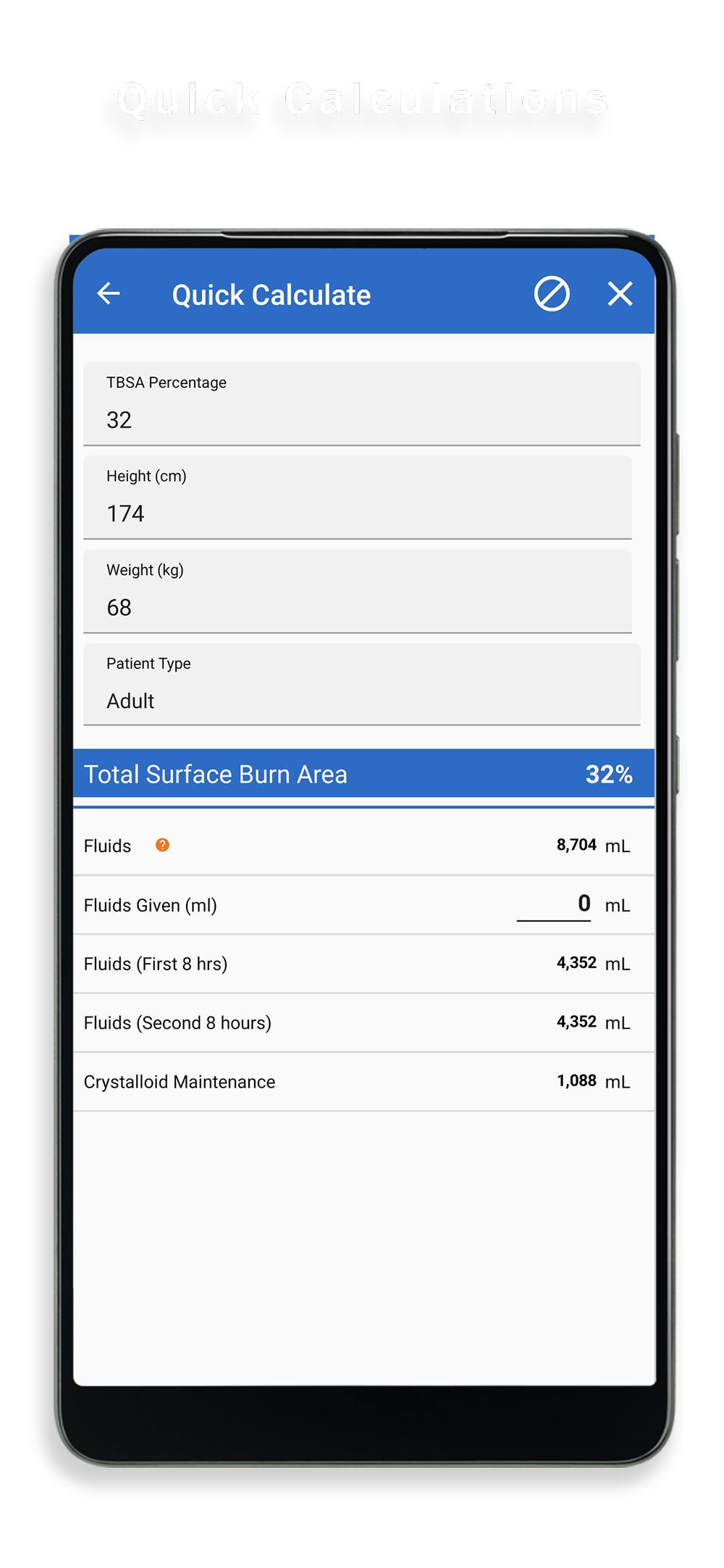 Surface Burn Calculator — CodeSoupCafe LLC