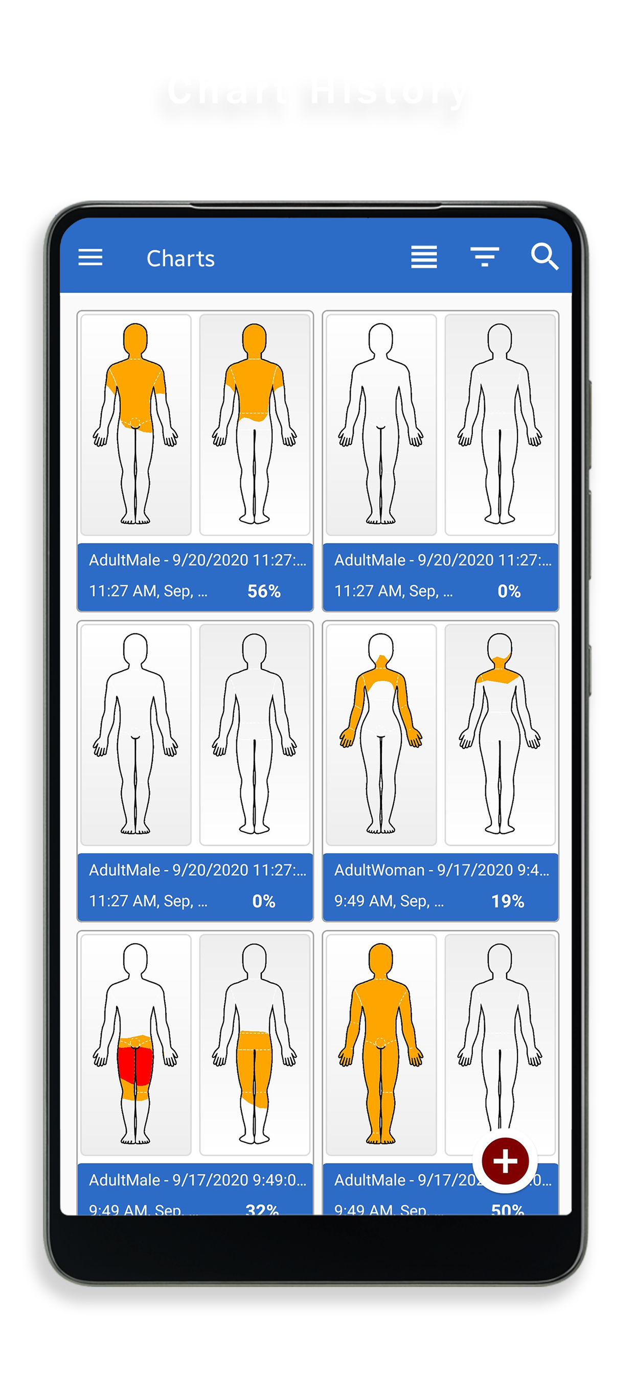 Surface Burn Calculator — CodeSoupCafe LLC