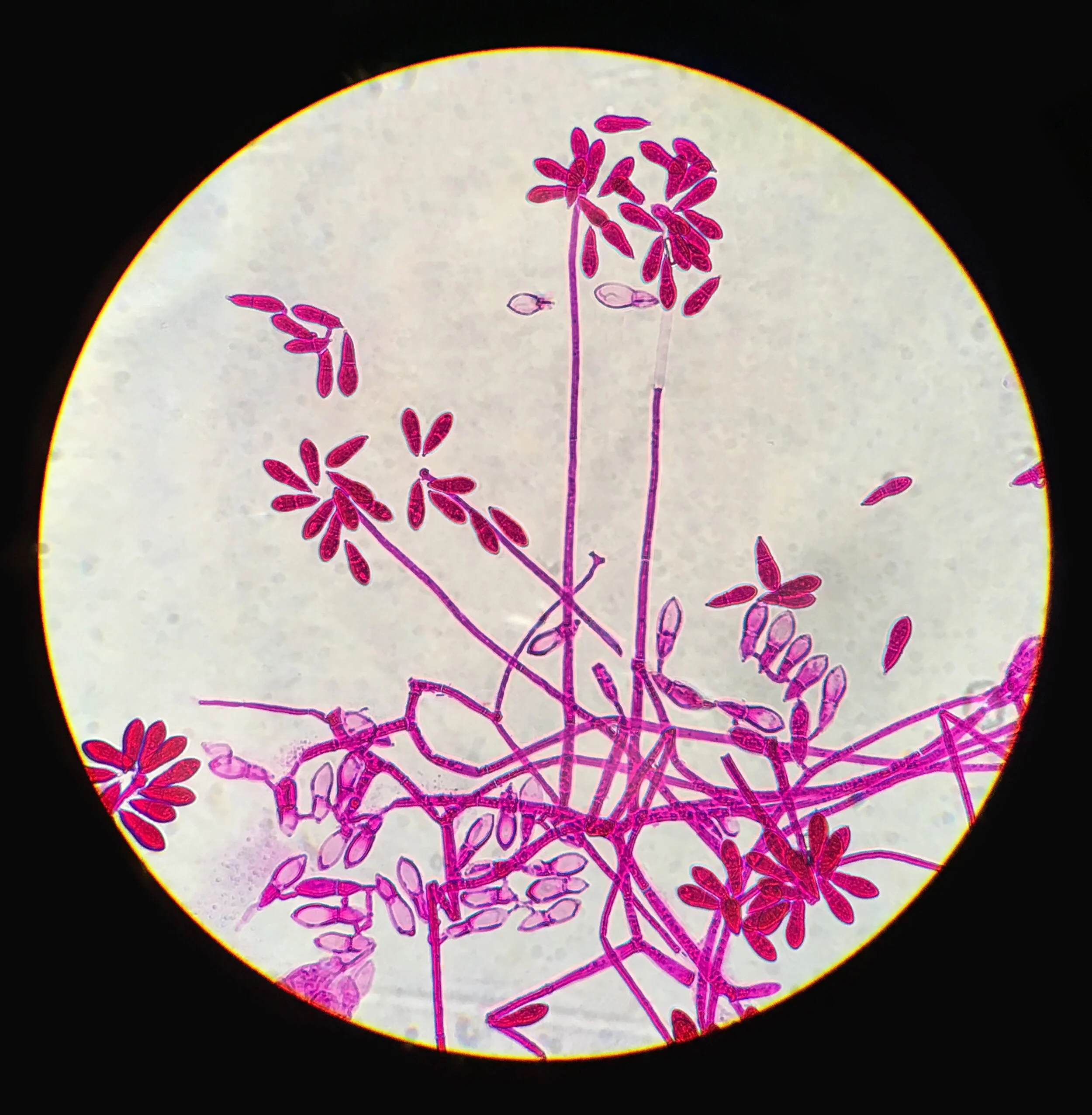 Meet the fellows — The Microbe Institute