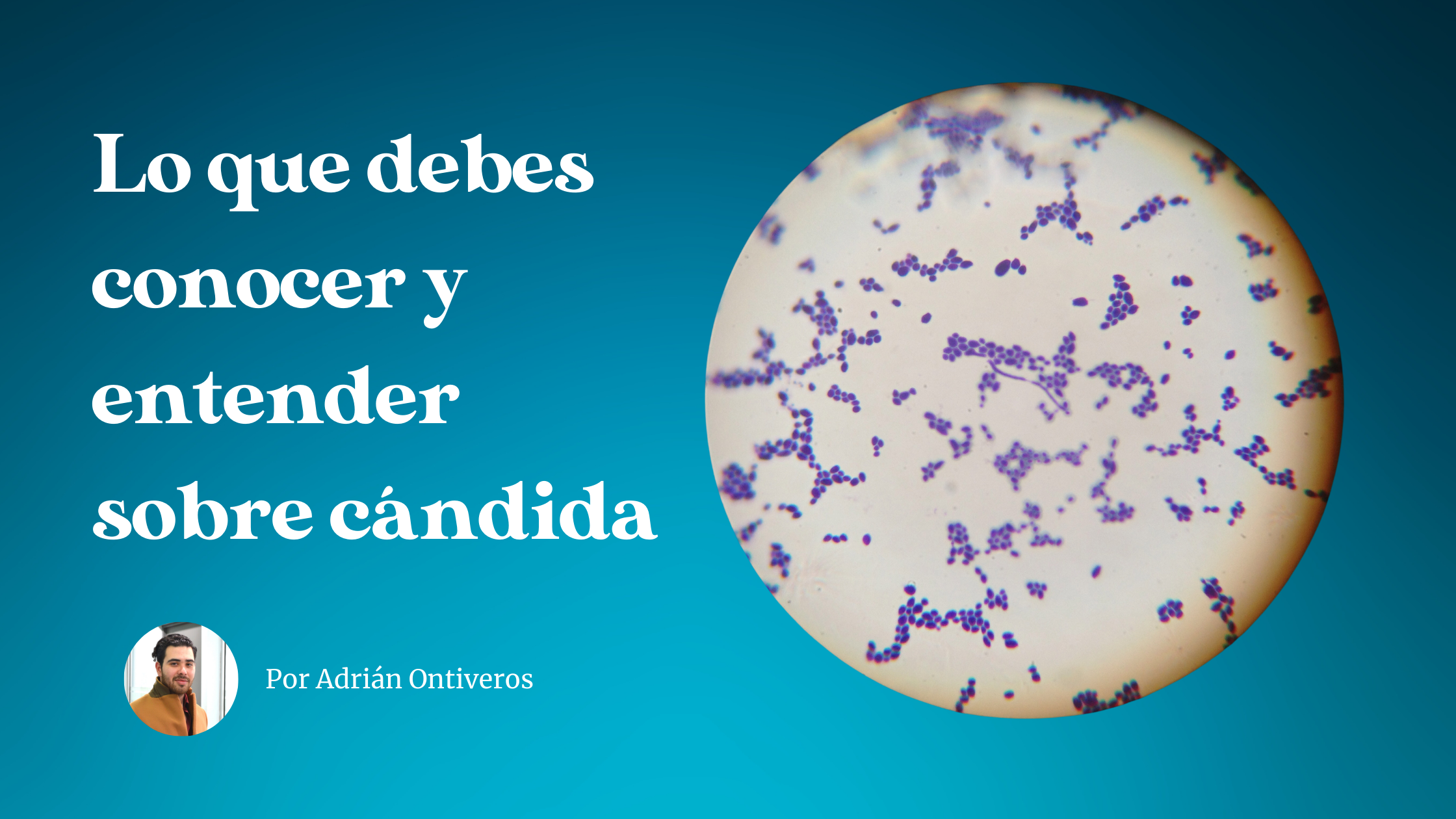Cándida: Cómo saber si la tienes, cómo prevenirla y cómo tratarla ...