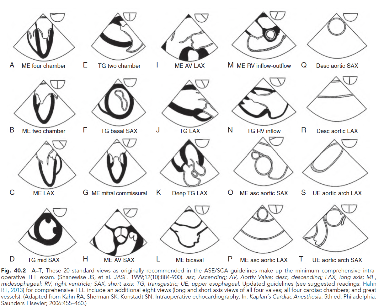 TEE Resident Elective — UH Anesthesiology
