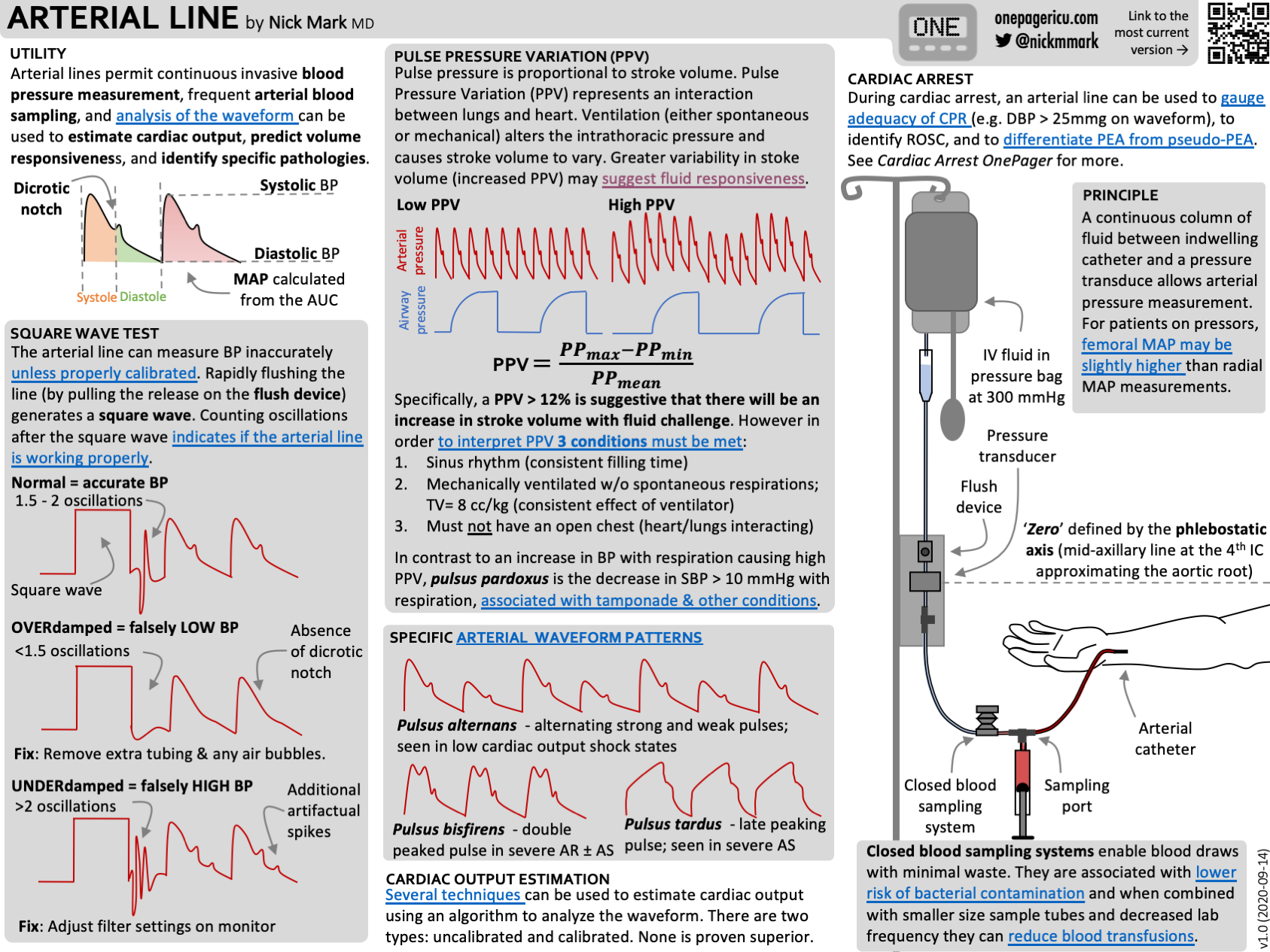 Arterial Lines ICU One Pager Arterial Lines ICU One Pager