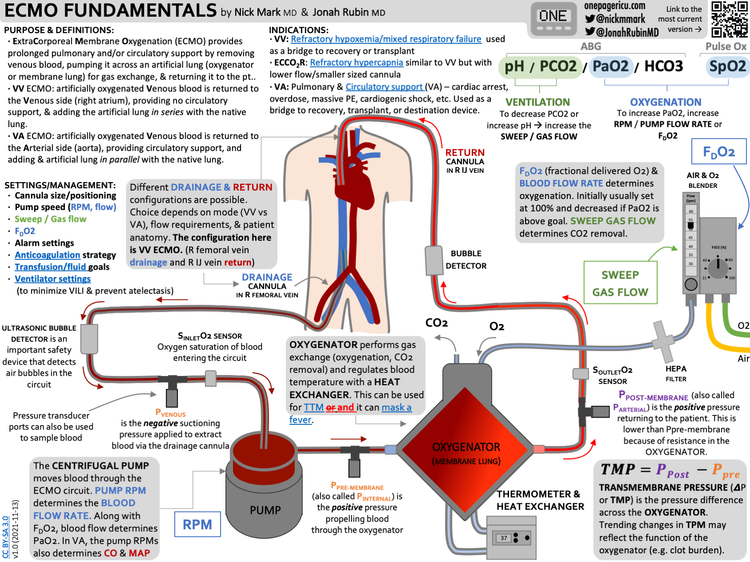 ECMO Fundamentals — ICU One Pager