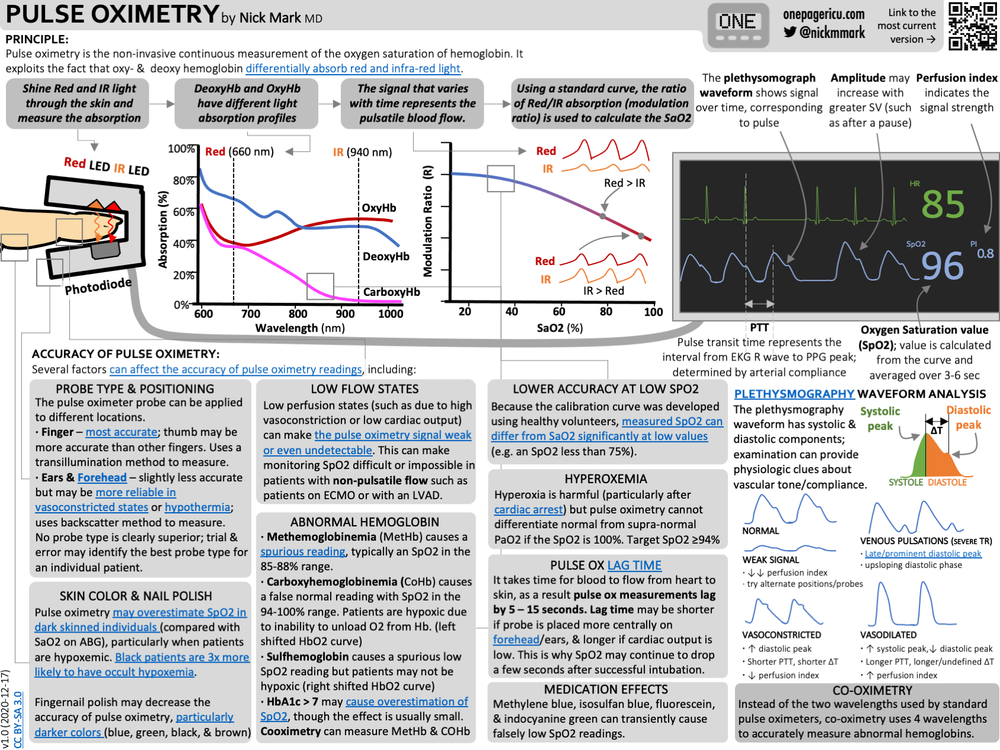 Pulse Oximetry — ICU One Pager