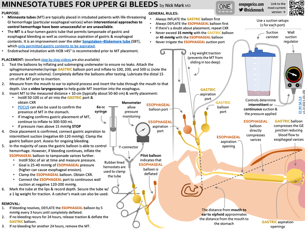 Minnesota Tubes — ICU One Pager