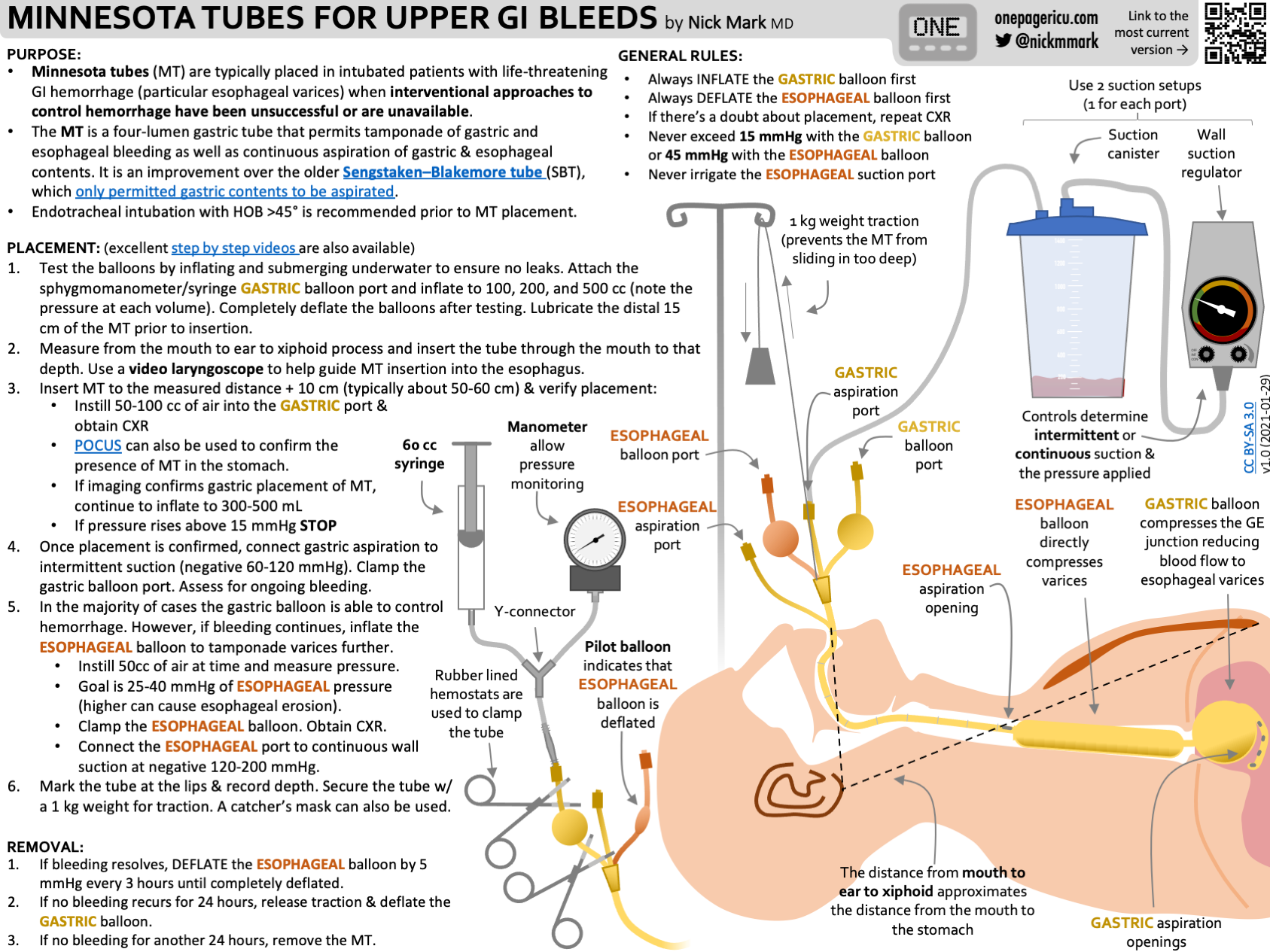 Minnesota Tubes — ICU One Pager