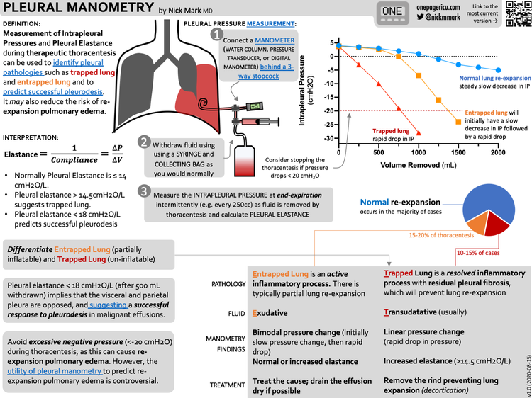 Pleural Manometry — ICU One Pager