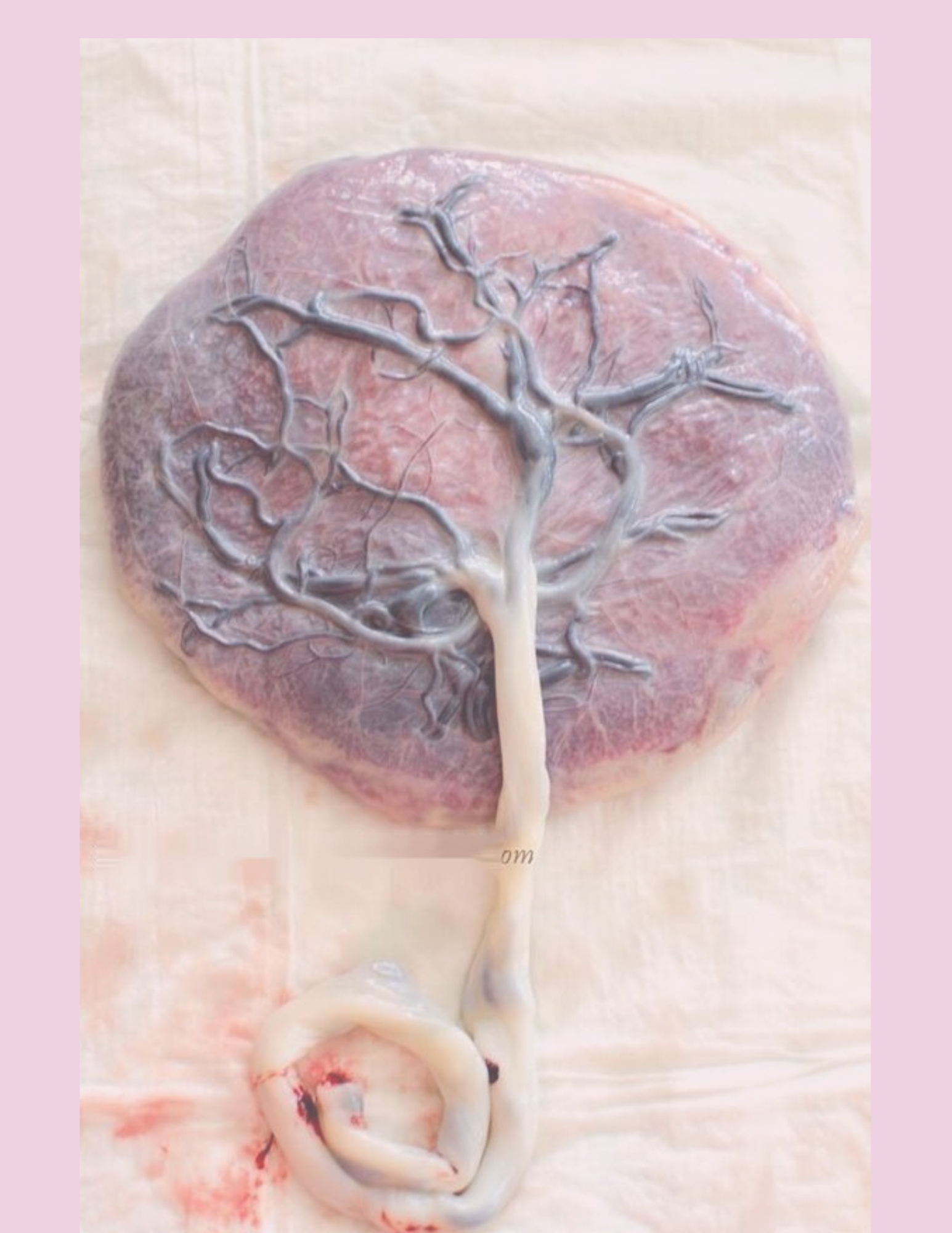 Human Placenta After Birth