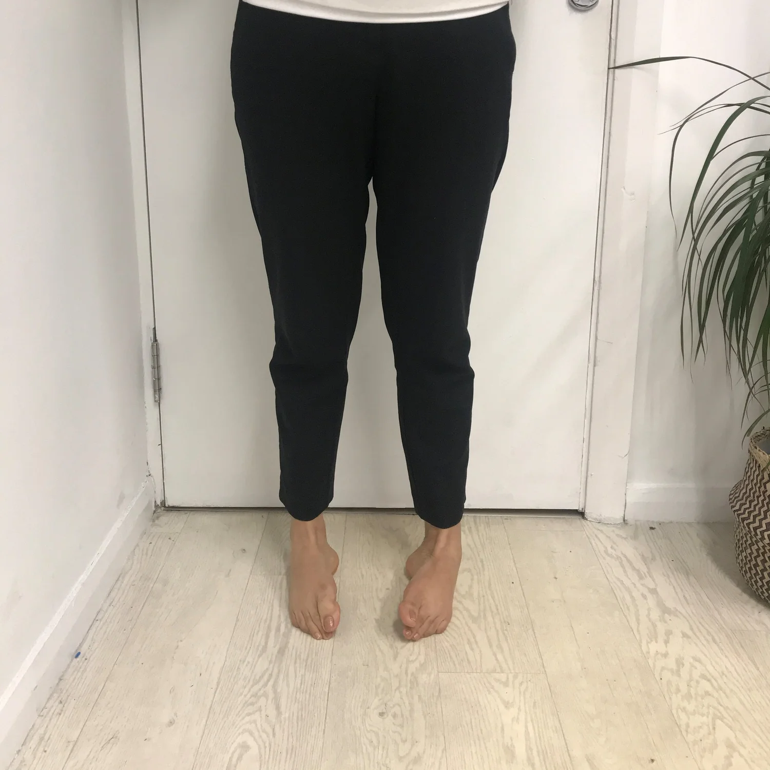 Why do I have dropped arches? - First Line Physio